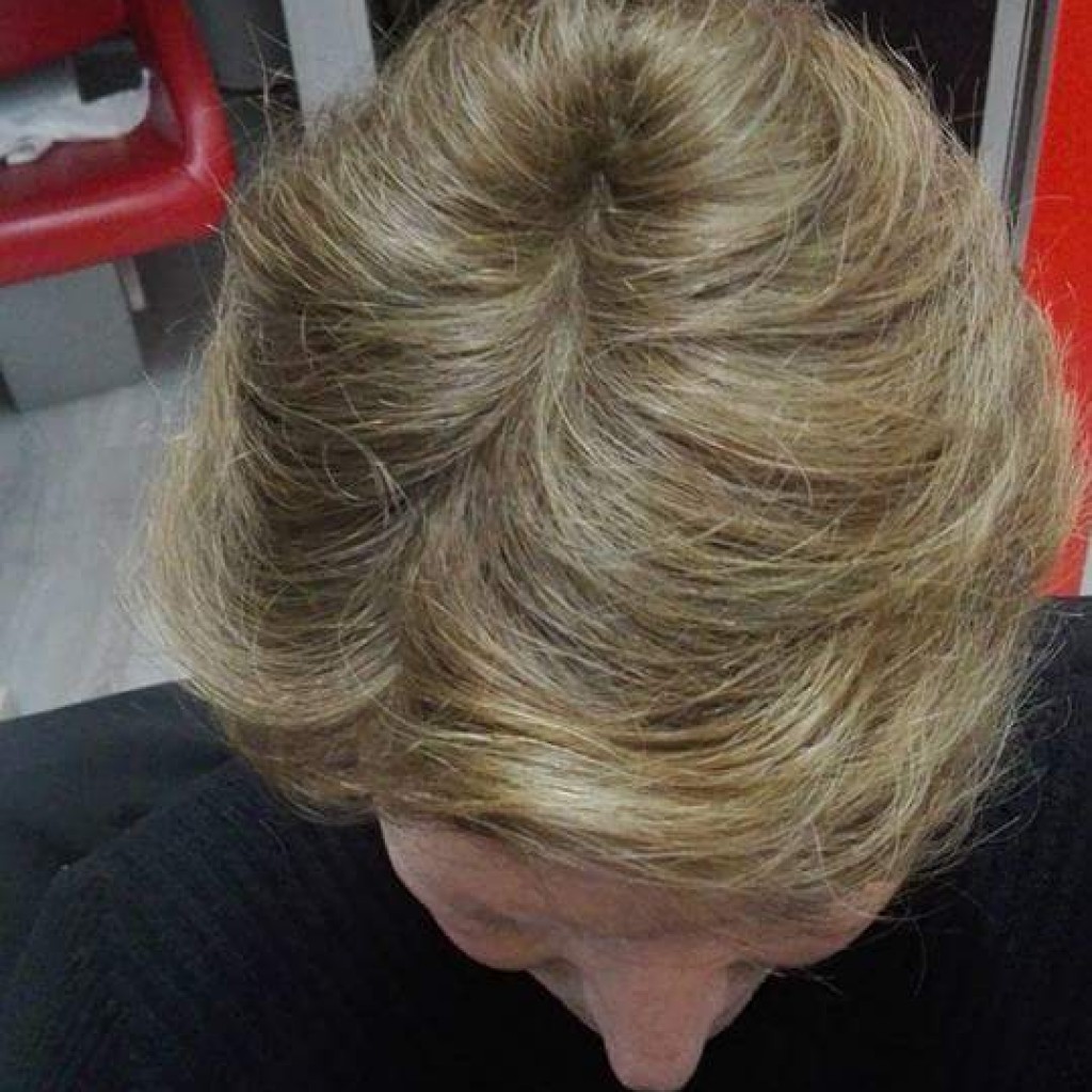 Prótesis capilares para mujeres - Centro Capilar A&L